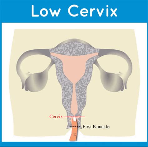 Best Menstrual Cups For Lowhigh Cervix And How To Measure It