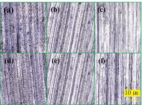 Surface Topography Of Different Areas Of The Tooth Surface Before And