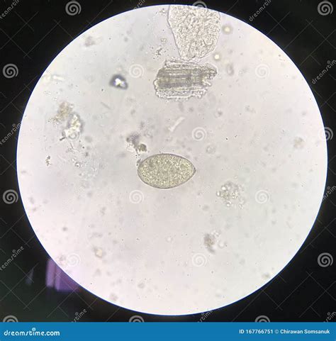 Egg Parasite Human In Stool Examination Stock Image Image Of Nematode