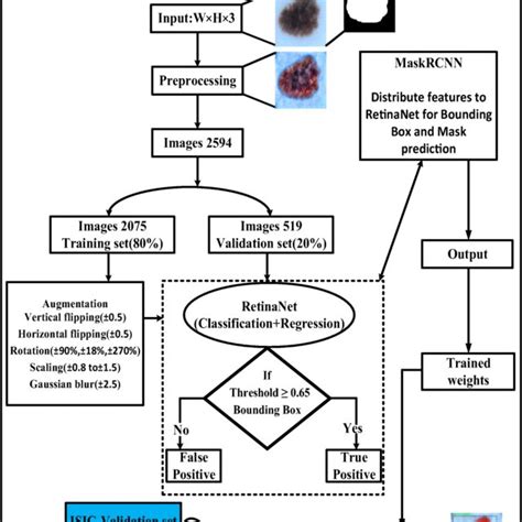 Flow Chart Of The Proposed Hybrid Melanoma Skin Cancer Lesion Detection
