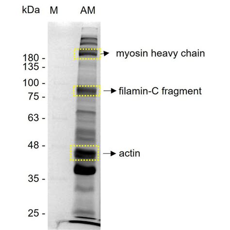 Sodium Dodecyl Sulfate Polyacylamide Gel Electrophoresis Sds Page