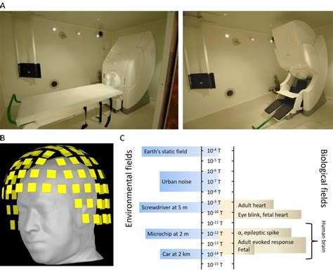 Magnetoencephalography Meg Neurophyscare