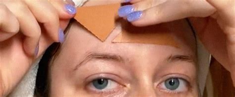 What Botox Alternative Is Sold At Target