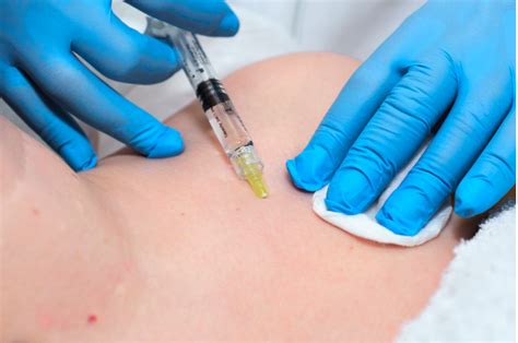 Acupuncture Point Injection Therapy Scottsdale Acupuncture And Alternative Medicine