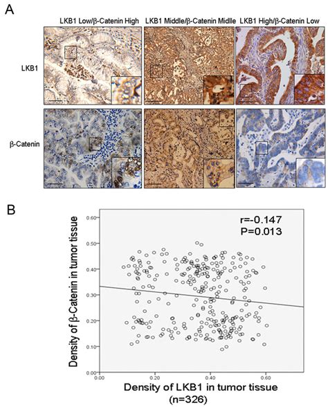 Inverse Correlation Between Lkb1 And Nuclear β Catenin In Icc Tissues Download Scientific