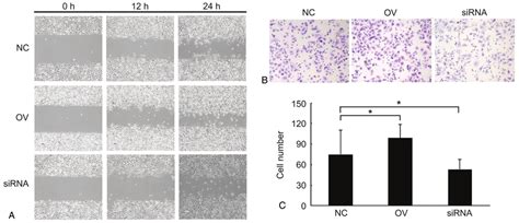 Acyl Coa Synthetase Long Chain 3 Regulates Akt Phosphorylation And The