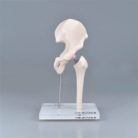 Hip Joint Models Jojenmed Inc Best Education Model China Manufacturer