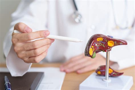 A Method Found To Predict Liver Disease Years Before Symptoms Appear