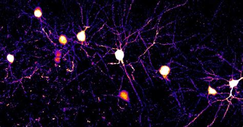 Unveiling Human Neuron Complexity New Discoveries News Directory 3