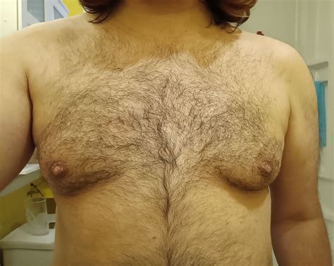 Nonbinary Hrt 2 Weeks Rtransbreasttimelines