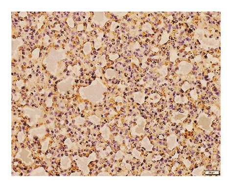Representative Photomicrographs Of Sp D Expression In The Lung Tissues