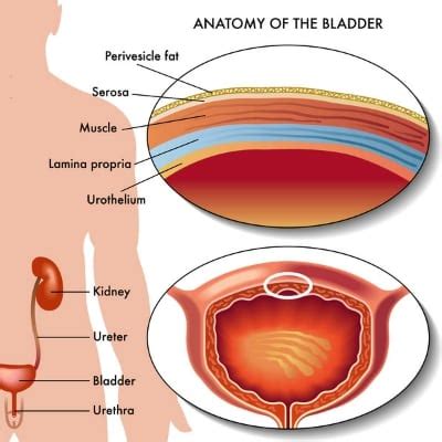 Blaasspoelingen Met Katheter Of Ialuadapter Andros Blaascentrum