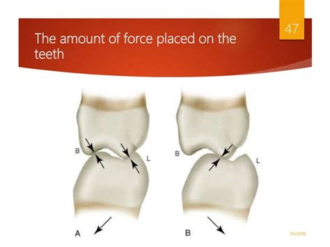 Criteria For Optimum Functional Occlusion PPTX