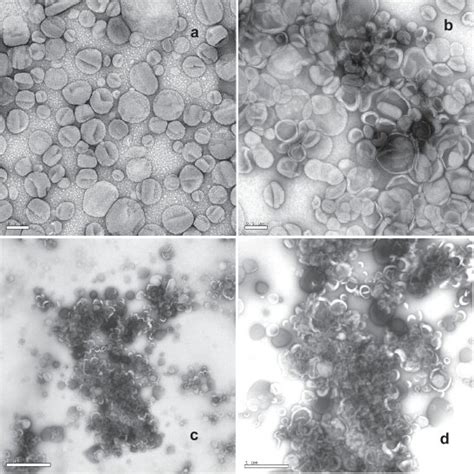 Negative Stain Electron Microscope Images 1 Uranyl Acetate Taken On