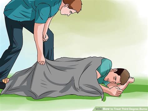 How To Treat Third Degree Burns With Pictures Wikihow Health
