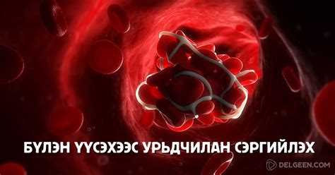 Энэхүү мэдээллийг уншсанаар та цус өтгөрөхөөс хэрхэн урьдчилан