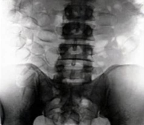 Forensics Chapter 13 Toxicology Flashcards Quizlet