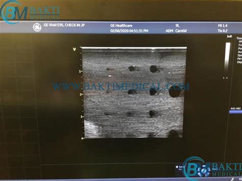 Ge Vivid E95 Ultrasound Machine Bakti Medical