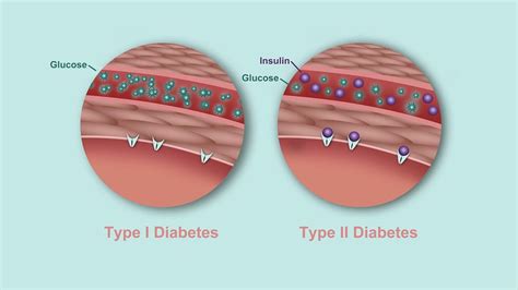 Insulin For Sliding Scale How Sliding Scale Works Insulin Is A Hormone Insulin Sliding Scale