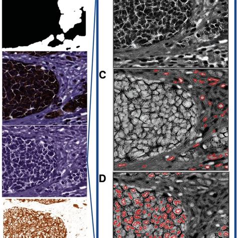 Cell Nuclei Segmentation Of Melan A Stained Tmas Tissue Spot Images Download Scientific
