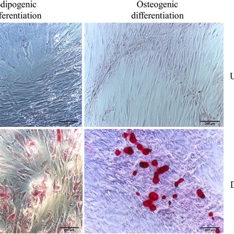 Adipogenic And Osteogenic Differentiation Of Hucmscs After 14 Days