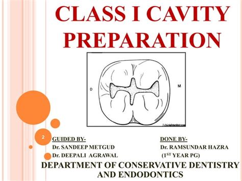 Class I Cavity Preparation Pptx