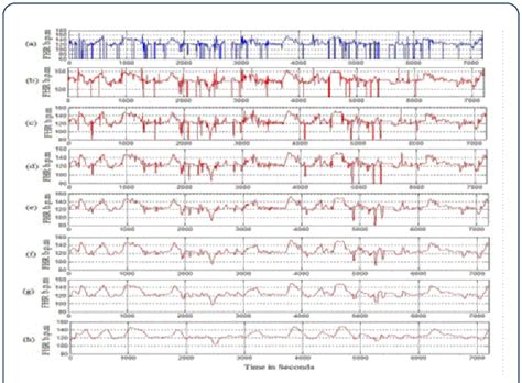 A The Noisy Fhr Signal B The Denoised Fhr Signal With W 1 C Download Scientific Diagram