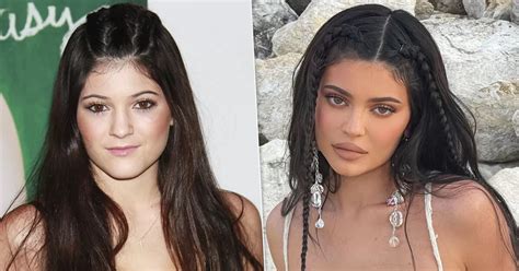 جراحی زیبایی کایلی جنر کایلی جنر قبل و بعد همه چیز درباره خالکوبی