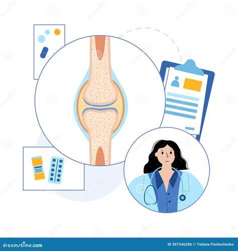 Synovial Joint Poster Stock Vector Illustration Of Bone 307546286