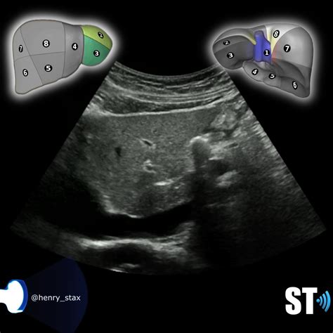 Segments Of Liver Anatomy