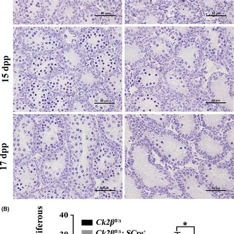 Histological Analysis Of The Caudal Epididymides From Ck2βflΔ And