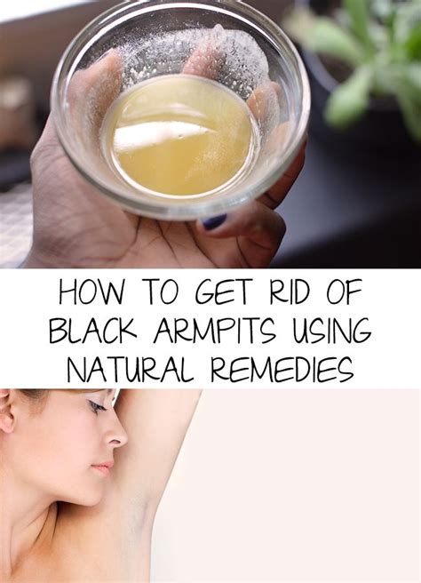 How To Get Rid of Black Armpits Using Natural Remedies | new me 2017 | Black armpits, Beauty ...