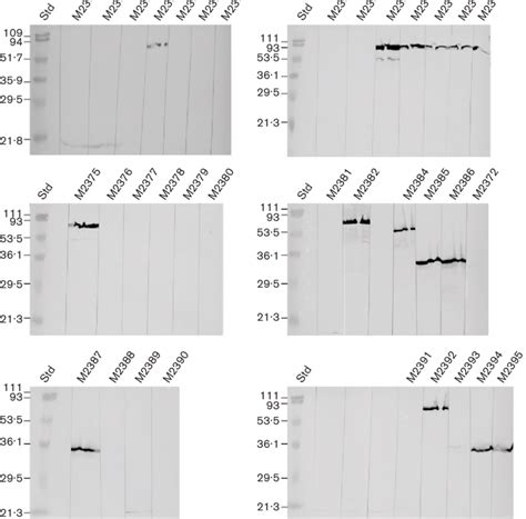 Western Blot Analysis Of Total Cell Proteins Of L Monocytogenes