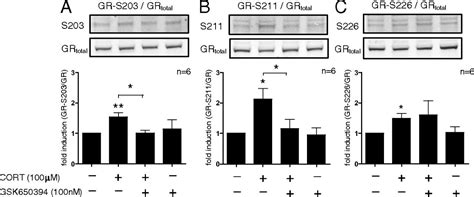 Role For The Kinase Sgk1 In Stress Depression And Glucocorticoid