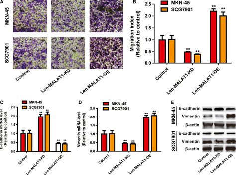 Lncrna Malat1 Increases The Migration Ability Of Gastric Cancer Cells
