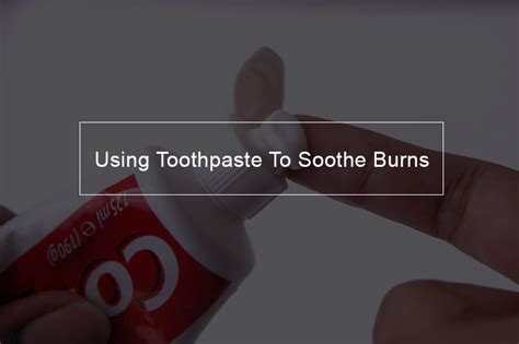 Is Toothpaste Good For Burns
