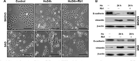 Figure 2 From Epithelial Mesenchymal Transition Emt Is A Key