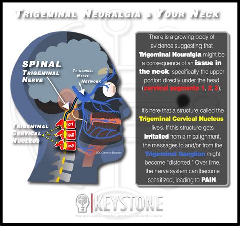 Tmj Doctor Distinguishes Trigeminal Neuralgia From Tmj Issues