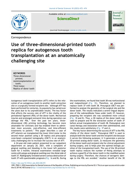 Pdf Use Of Three Dimensional Printed Tooth Replica For Autogenous Tooth Transplantation At An