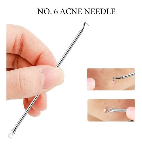 Kit Pin A Extrator Removedor De Cravo Espinha Acne Pe As Mercado Livre