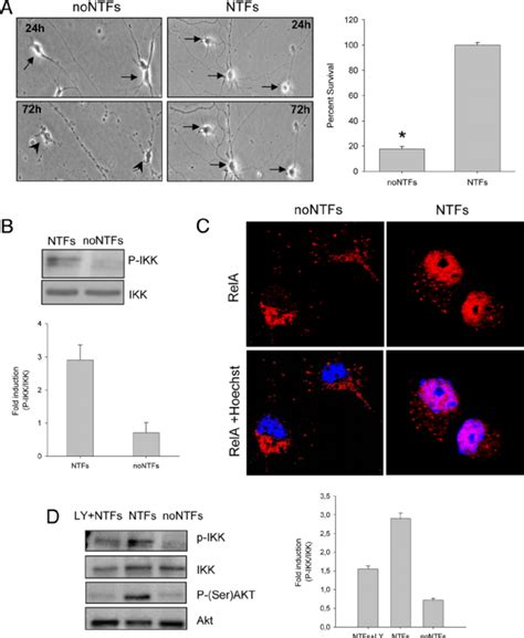 Effect Of Ntfs On Ikk Phosphorylation And P65 Nuclear Translocation A