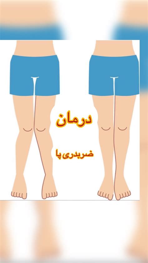 ‎زندگی صحیح و سلامتیحسین‌تقی‌زاده‎ ‎قوز بند با یک تیکه پارچه عزیزانی