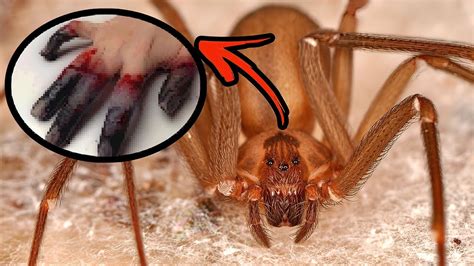 Dangerous Spider Bites