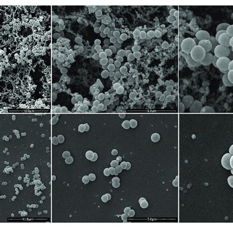 Scanning Electron Micrographs Sem Above Control Not Treated