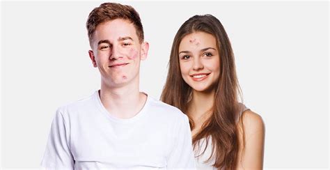 DALTON Beauty Magazin Profi Tipps Zur Richtigen Hautpflege