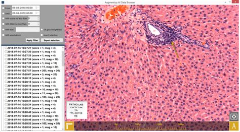 Digital Pathology Microscope Camera Augmentiqs