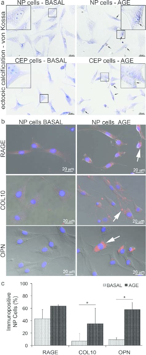 Inhibition Of Rage Reduces Effect Of Ages On Np Cell Differentiation