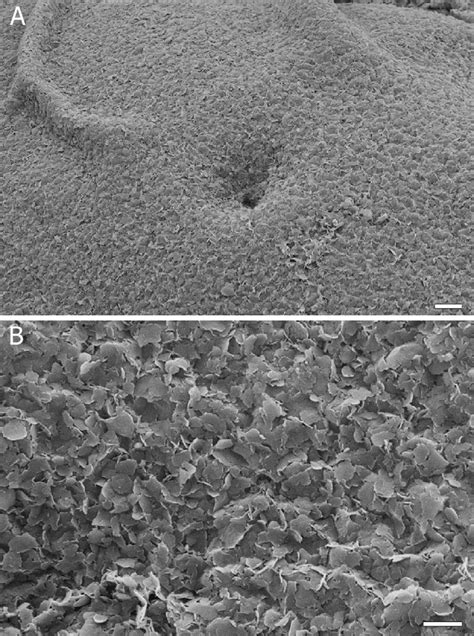 Scanning Electron Micrographs A Low Magnification View Showing Pore