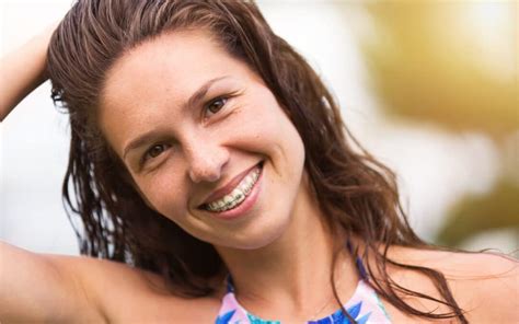 Getting Braces What To Expect And What To Do About Pain