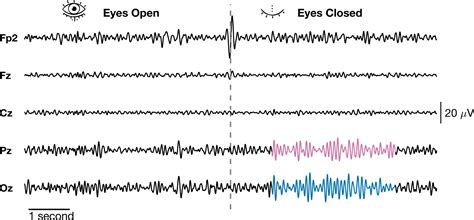 Making Nice Figures In MATLAB Part EEG Timeseries Data